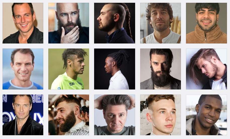 Receding Hairline in Black Men: Causes, Diagnosis, Treatment